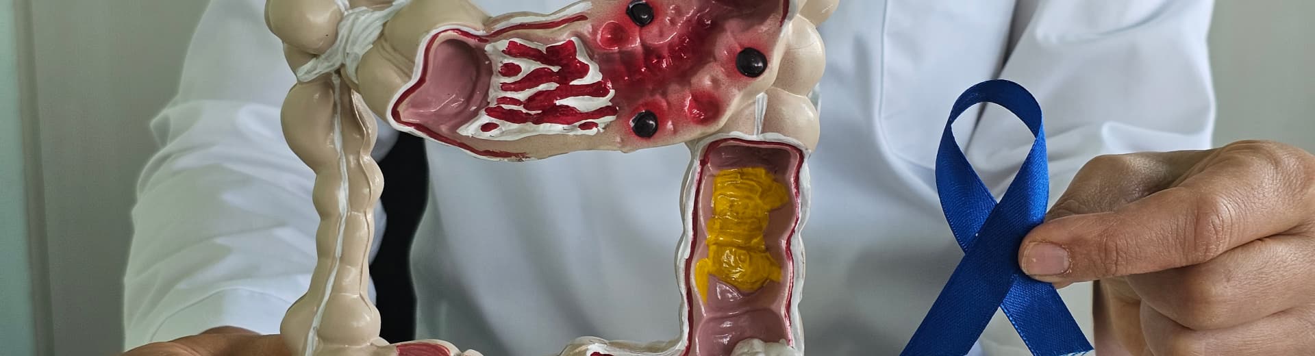 Colon Cancer Screening - MedStar Shah Medical Group